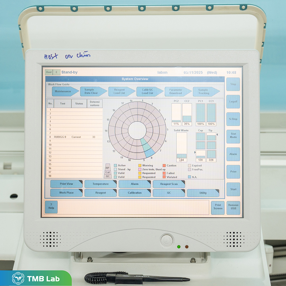 Bài viết - TMB Lab